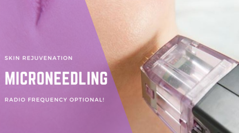 Microneedling vs. RF Microneedling: Which Skin Rejuvenation Treatment ...